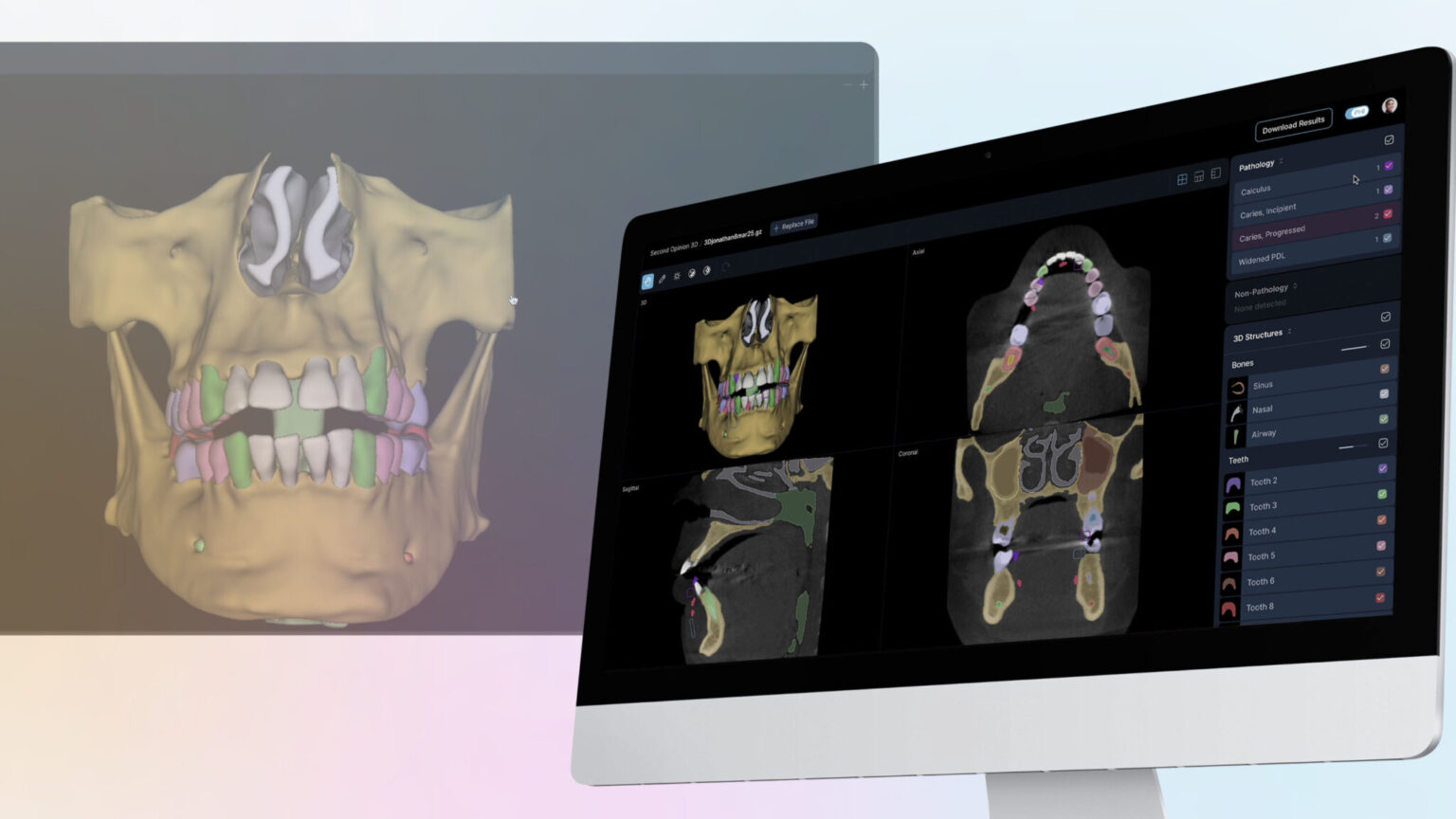 FDA Approved First AI Tool For 3D Scan Analysis